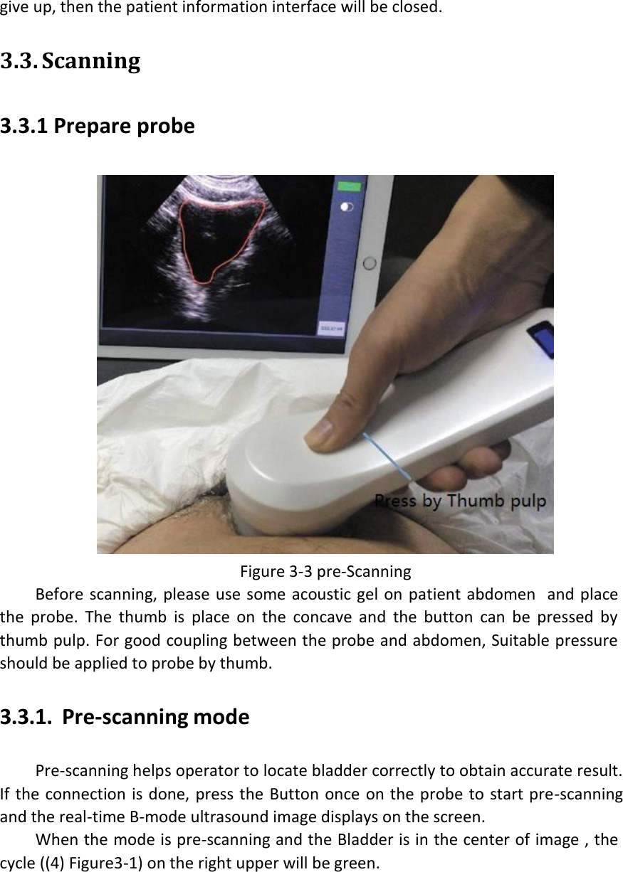 Guangzhou Sonostar Technologies BPROBE Wireless Probe Type Ultrasound ...