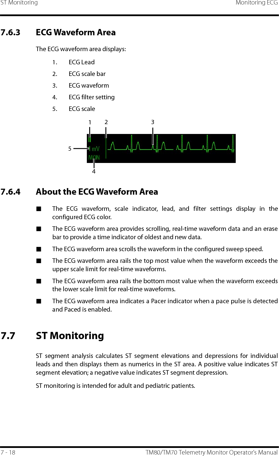 Mindray BIO Medical electronics WMTSTM70 Telemetry Monitor User Manual ...