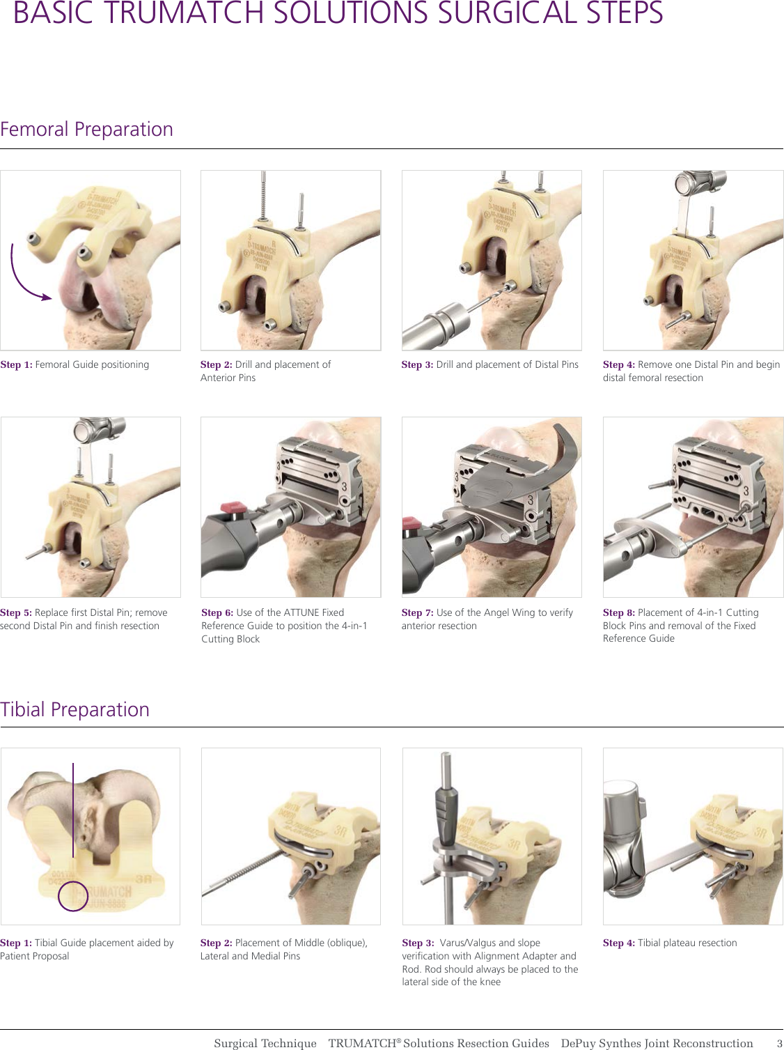 0612 04 514 TMAtn ST