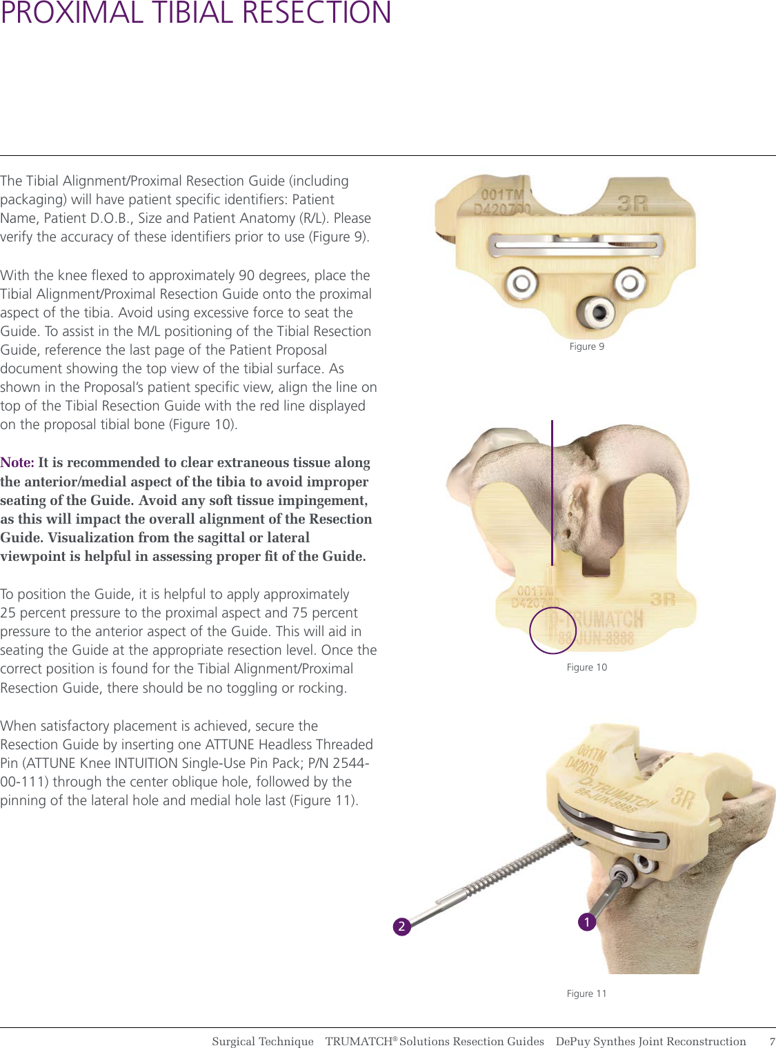 0612 04 514 TMAtn ST