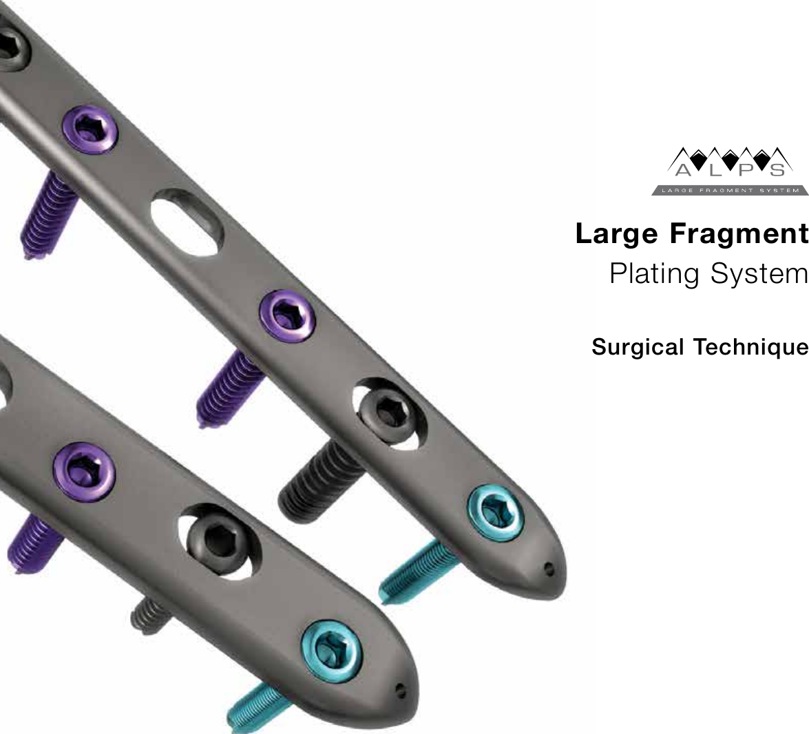 ALPS Large Fragment Surgical Technique