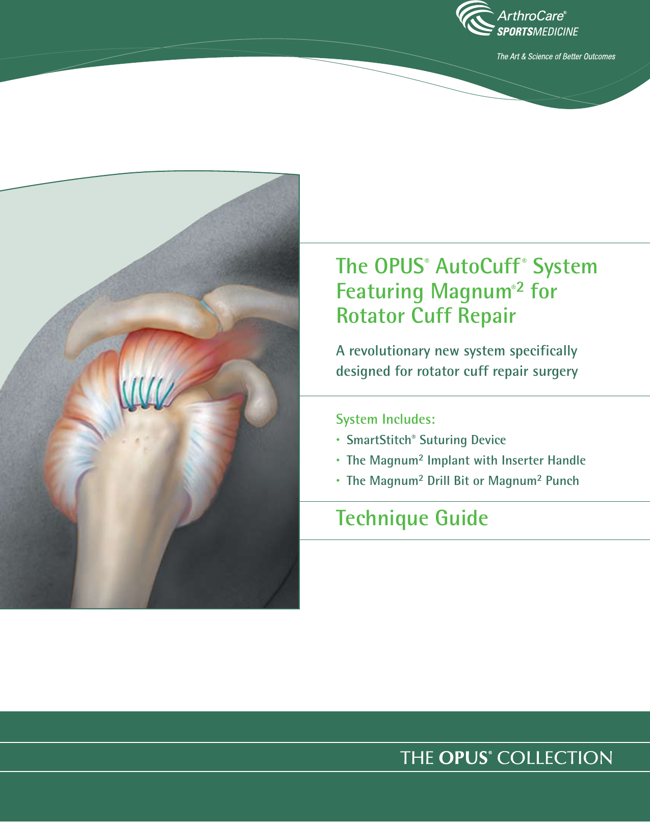 Arthrocare Auto Cuff Technique Guide