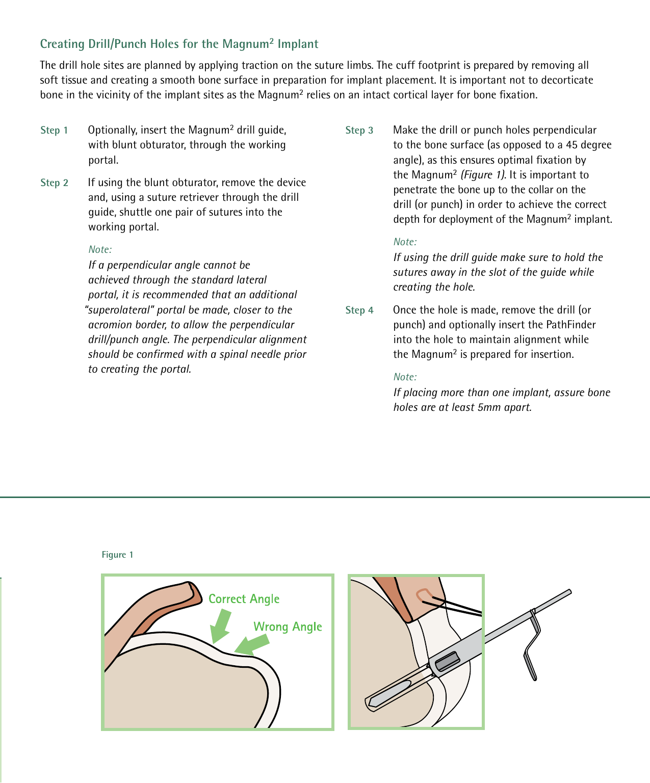 Arthrocare Auto Cuff Technique Guide