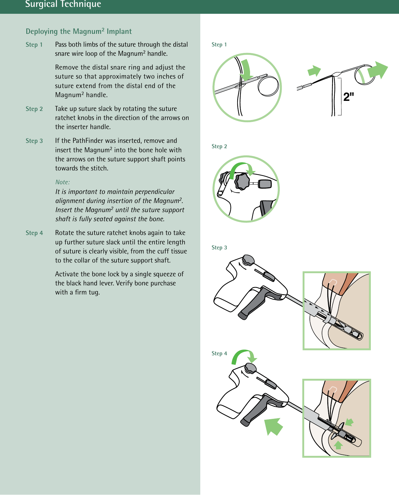 Arthrocare Auto Cuff Technique Guide