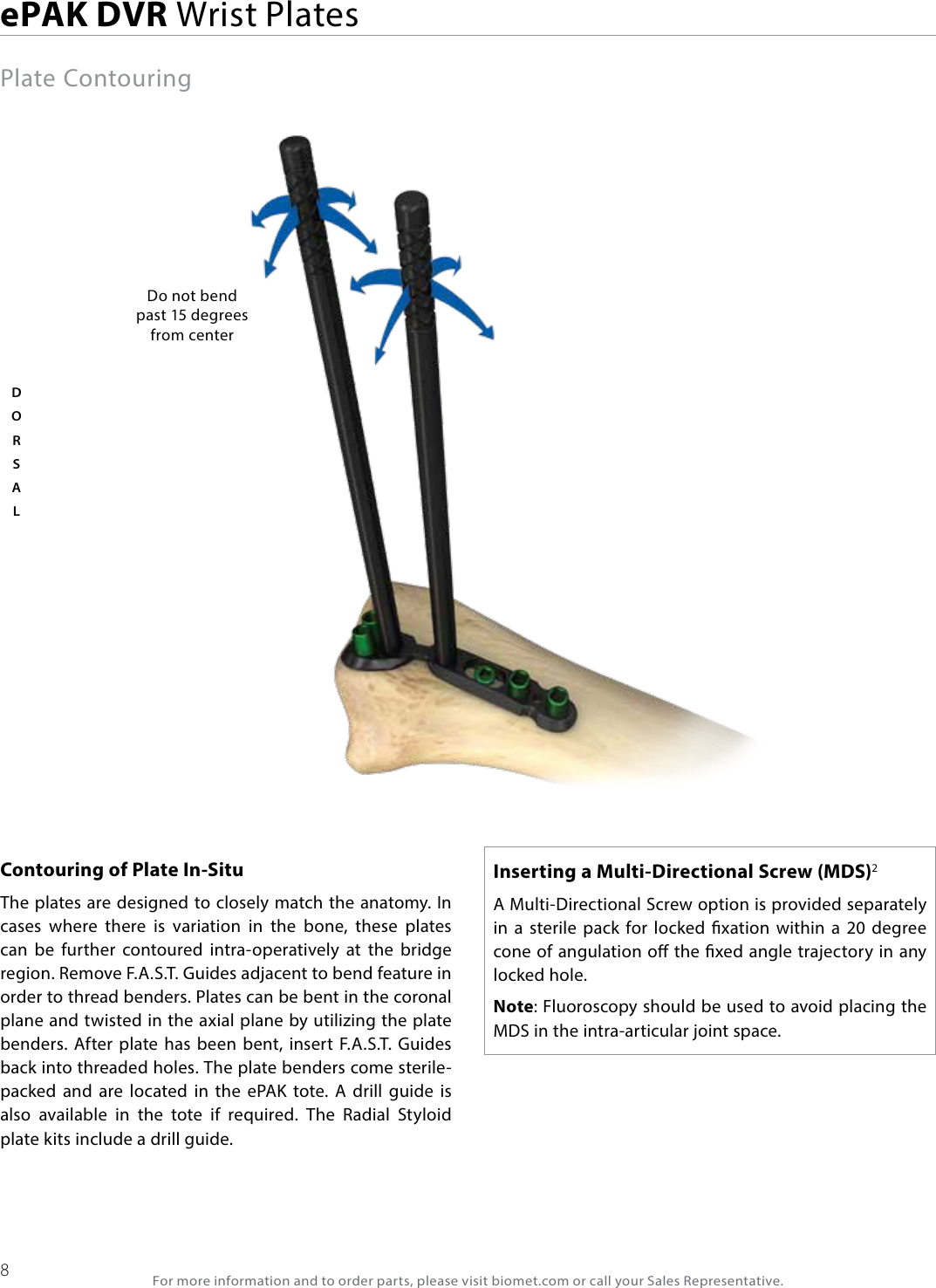 DVR Wrist Plates Featuring E PAK Surgical Technique