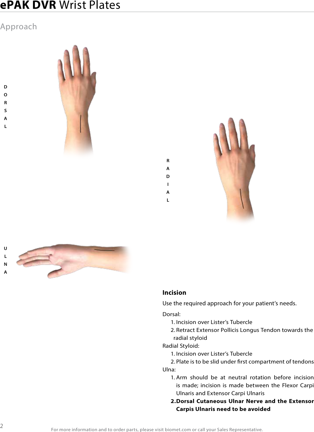 DVR Wrist Plates Featuring E PAK Surgical Technique