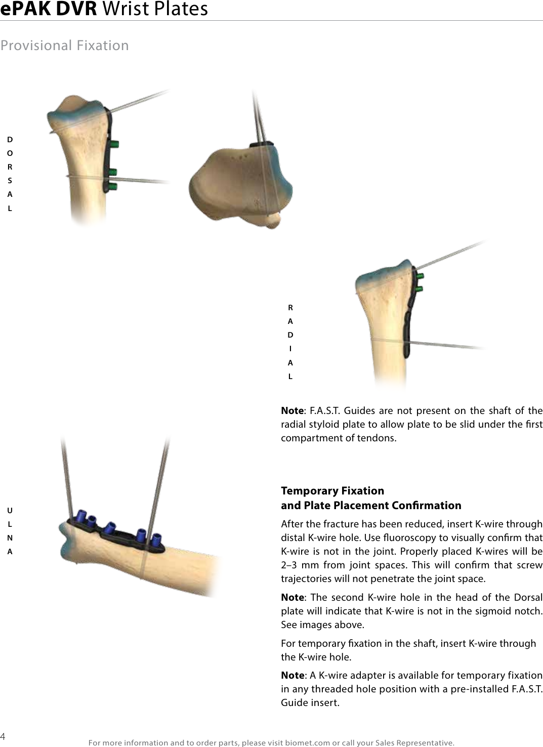 DVR Wrist Plates Featuring E PAK Surgical Technique