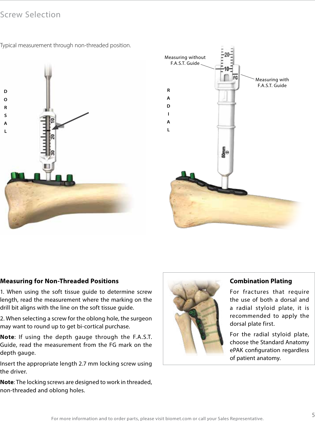 DVR Wrist Plates Featuring E PAK Surgical Technique