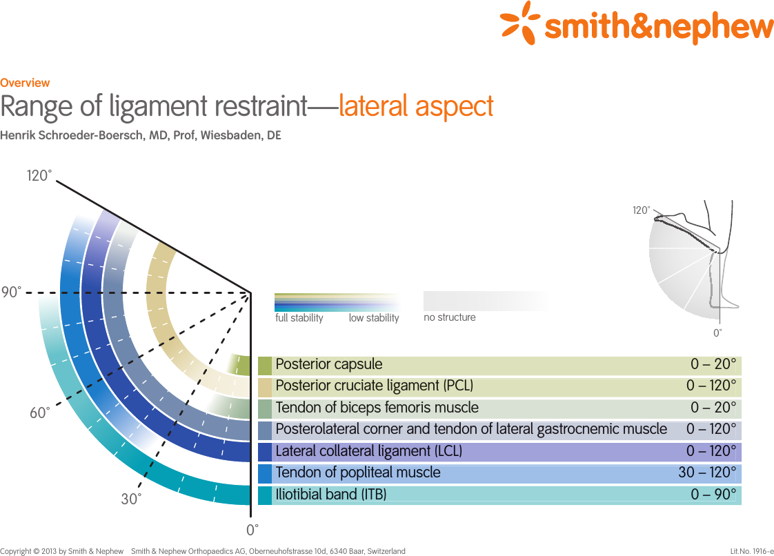 [SN13014]LigamentBal_2Sheets_03 Ligament Balancing Overview