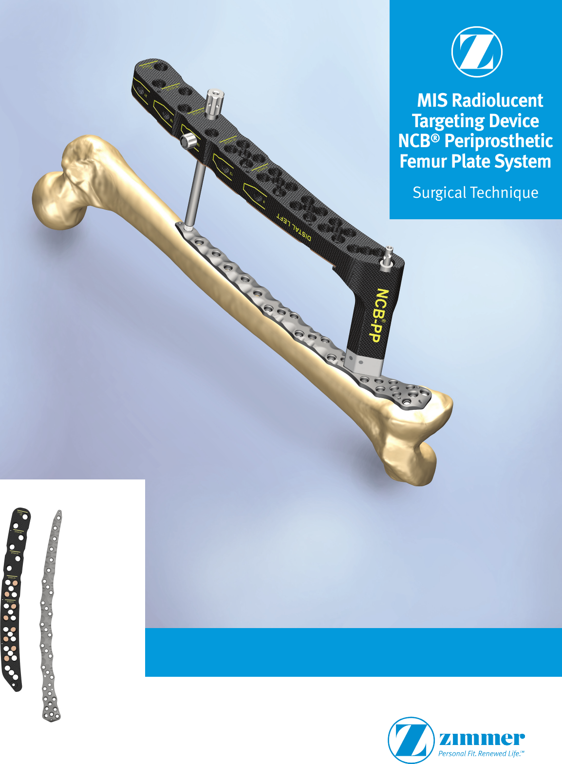 MIS Radiolucent Targeting Device NCB Periprosthetic Femur Plate System ...