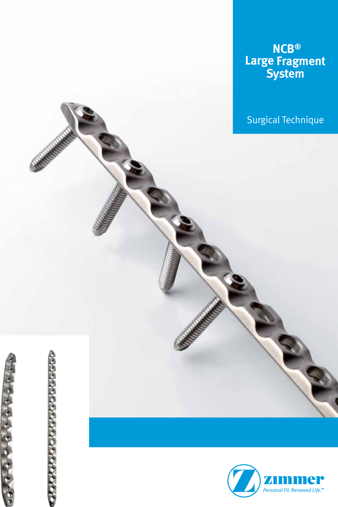 NCB Large Fragment System Surgical Technique