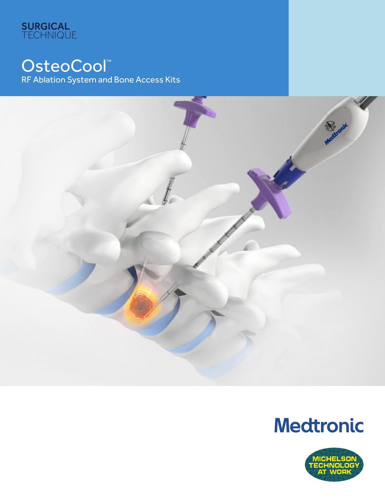 PMD016254 2.0 Osteo Cool TM Surgical Technique