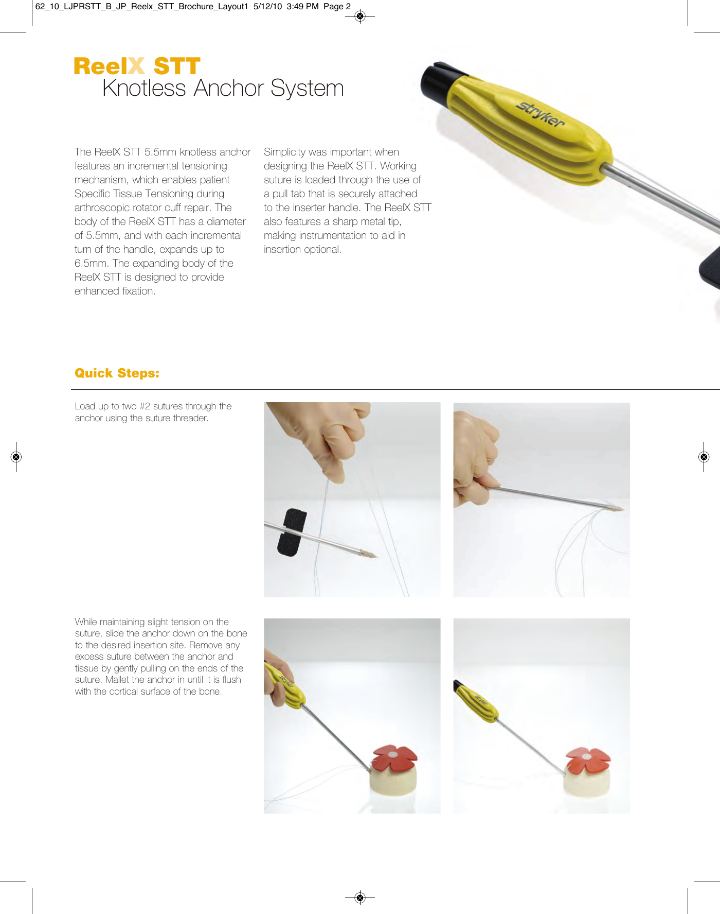 Stryker Brochure Plastic Coil Reelx Stt