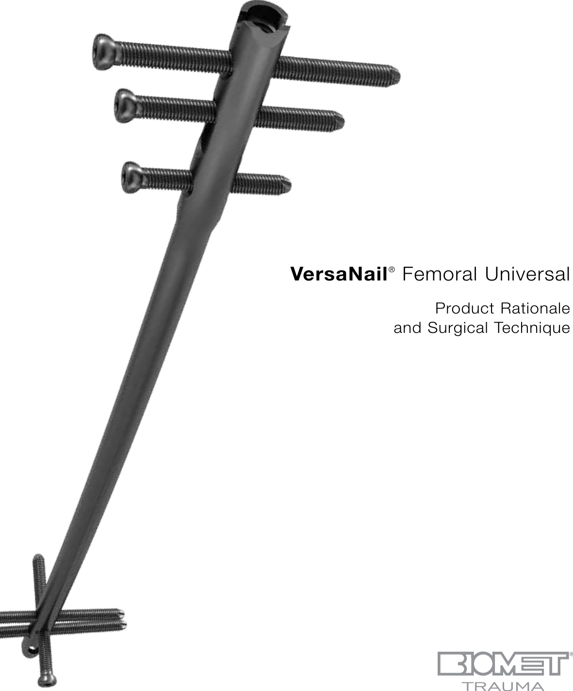 Versa Nail Femoral Universal System Surgical Technique