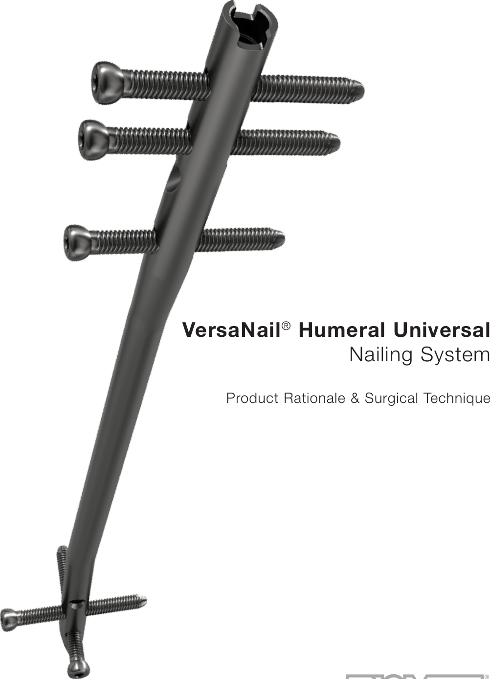 Versa Nail Humeral Universal Surgical Technique