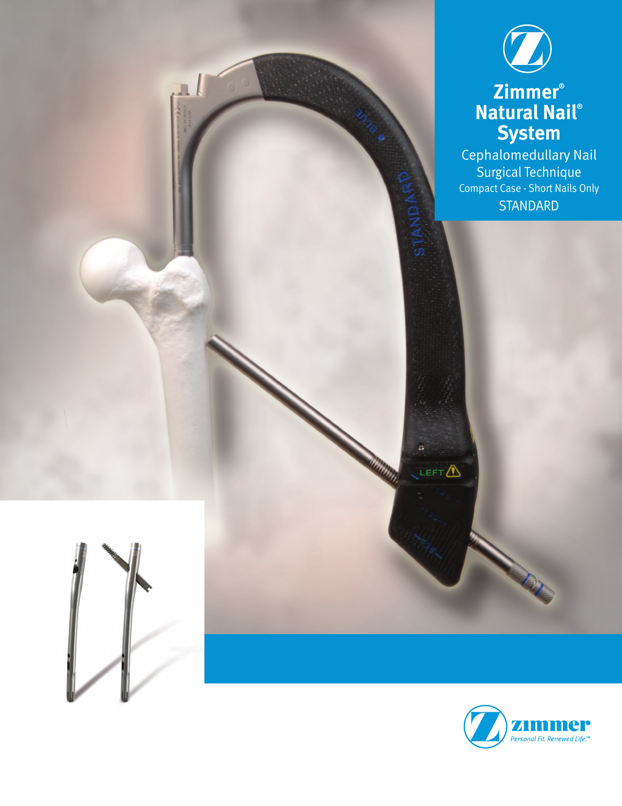 Zimmer® Natural Nail® System Cephalomedullary Nail Surgical Technique ...