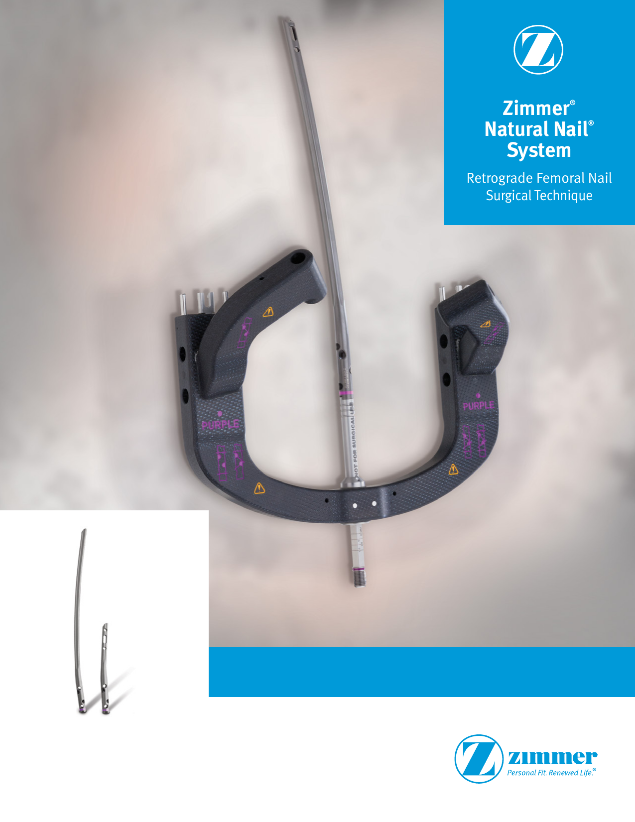 Zimmer® Natural Nail® System Retrograde Femoral Nail Zimmer Surgical ...