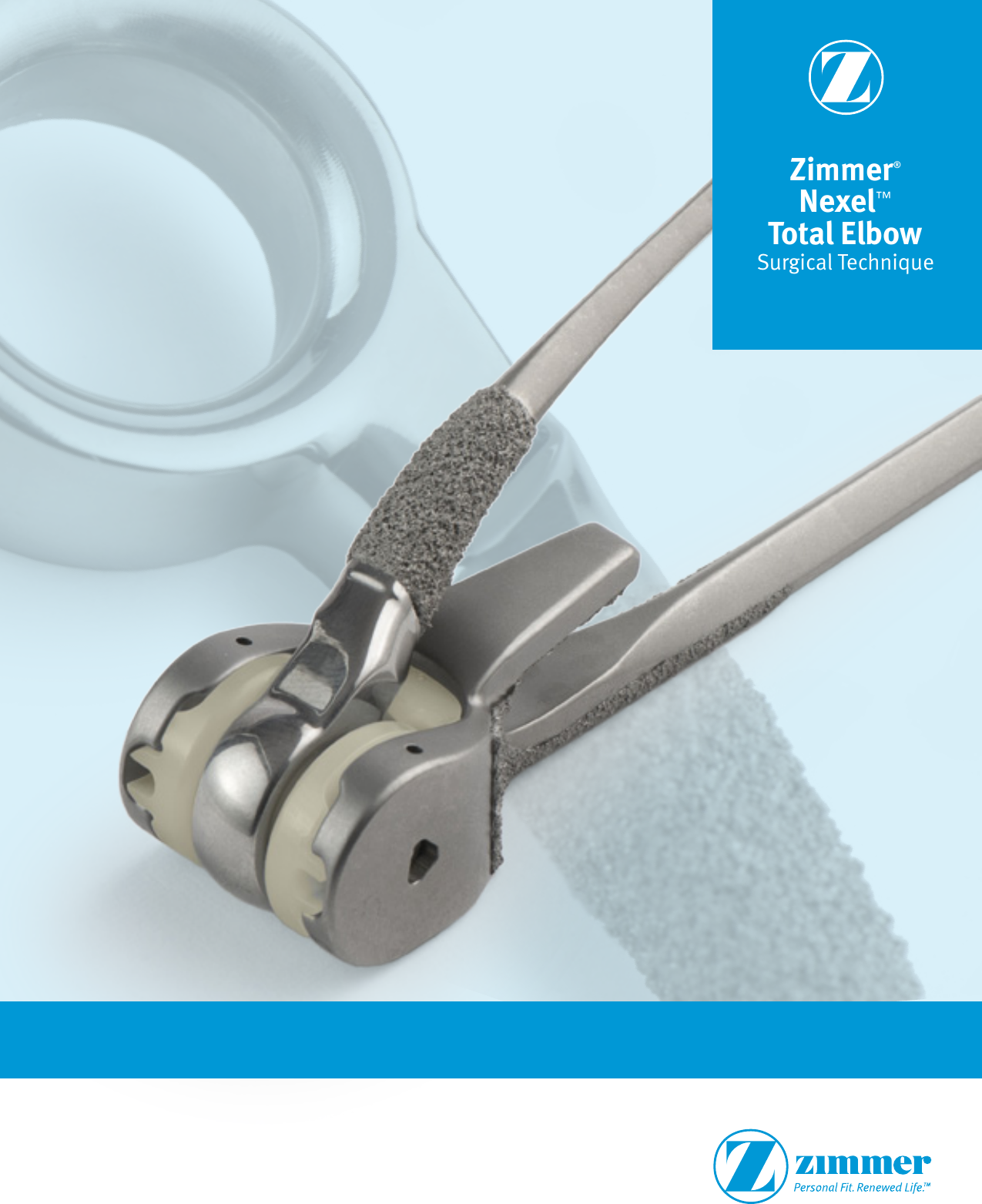 Zimmer Nexel Total Elbow Surgical Technique 97 8401 002 00