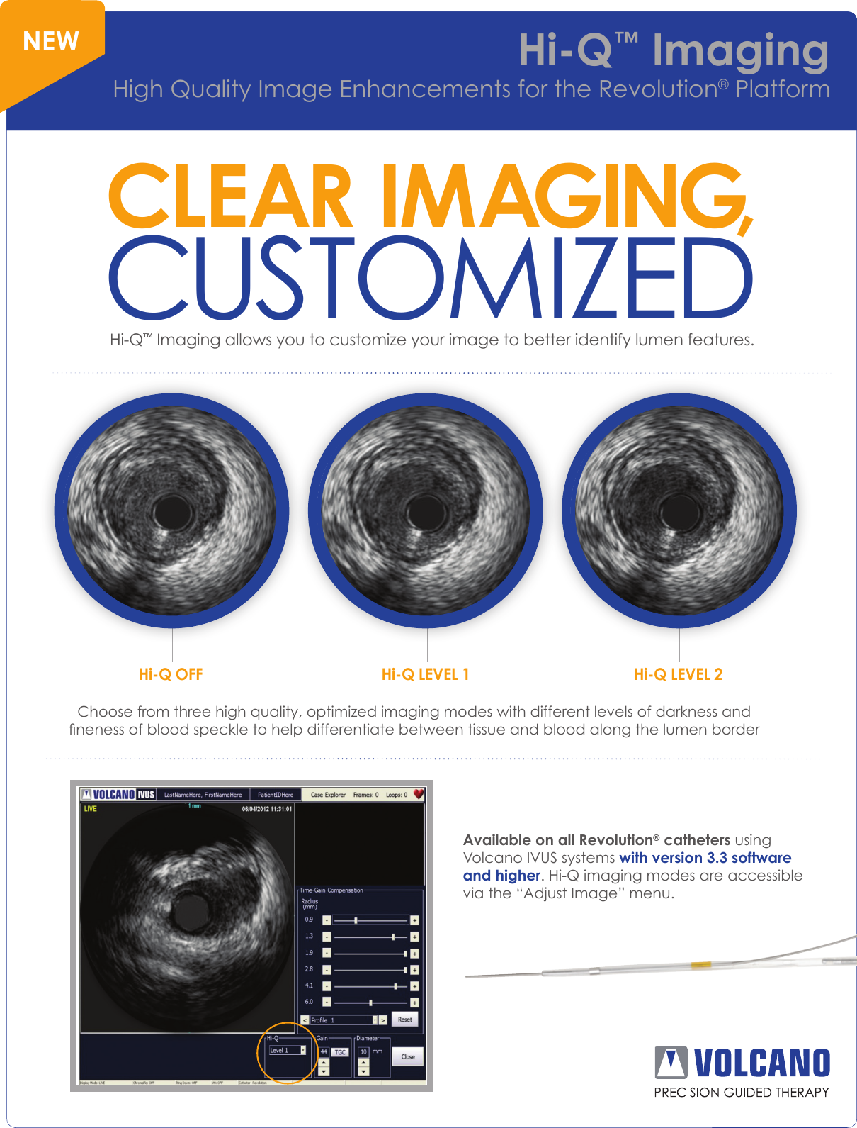 Volcano Corporation Rancho Cordova Ca