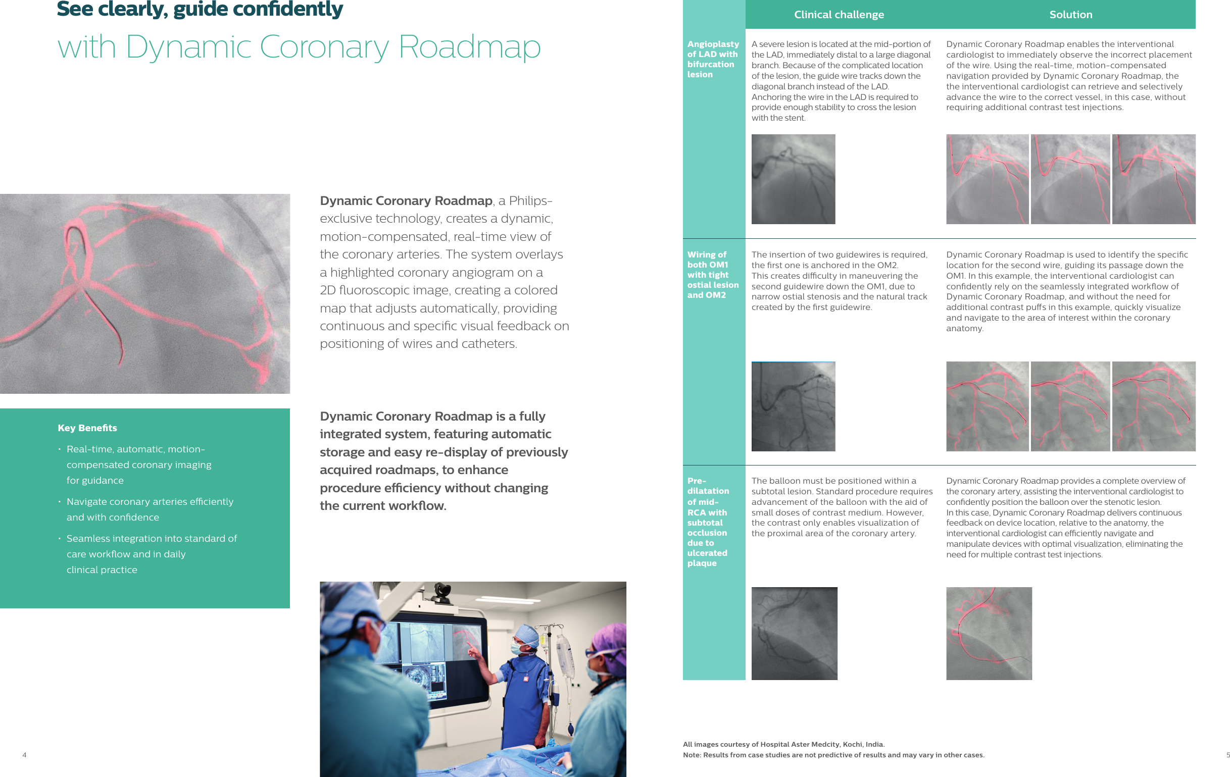 Philips DCR01 User Manual Product Brochure Dynamic Coronary Roadmap See ...