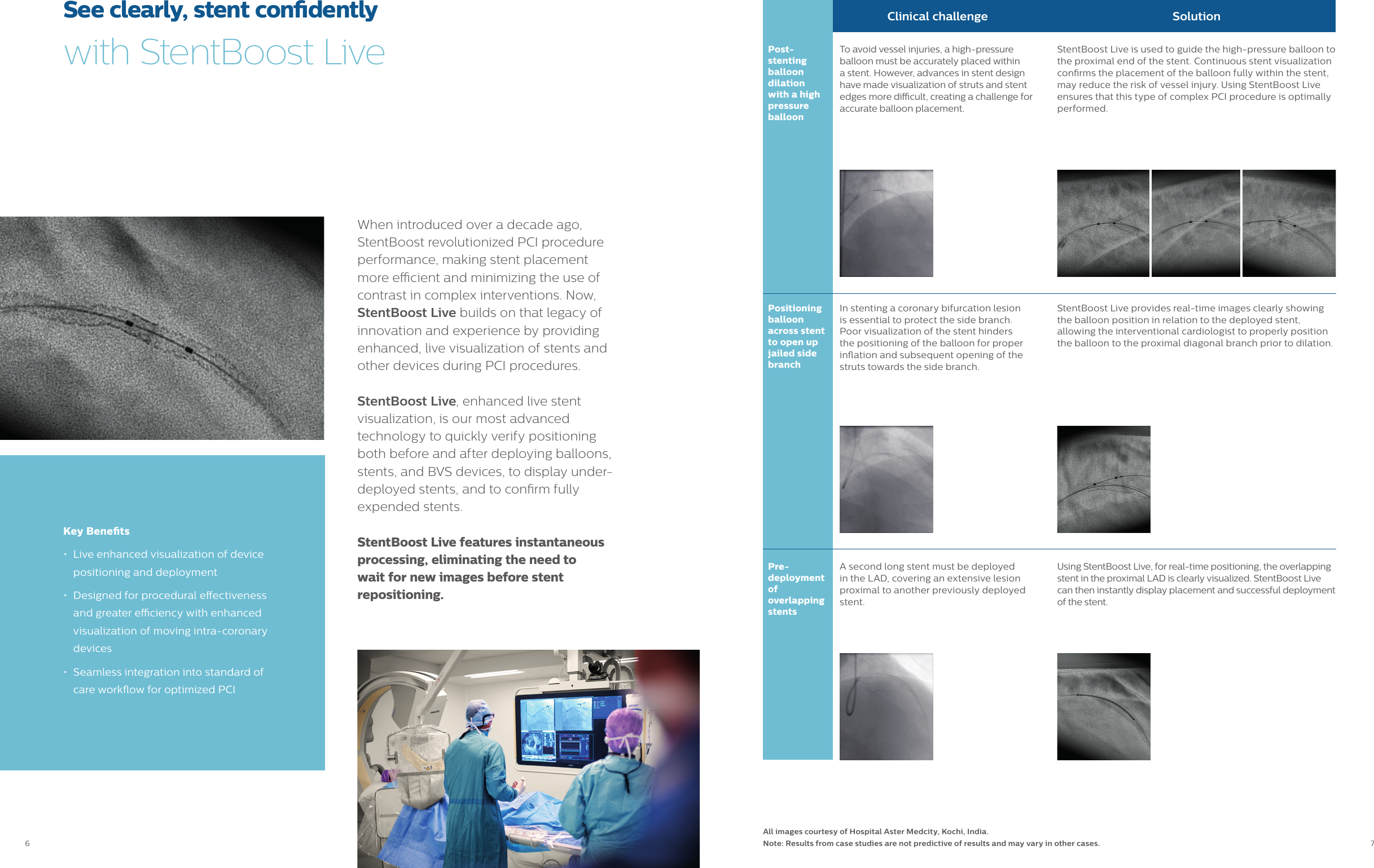 Philips DCR01 User Manual Product Brochure Dynamic Coronary Roadmap See ...