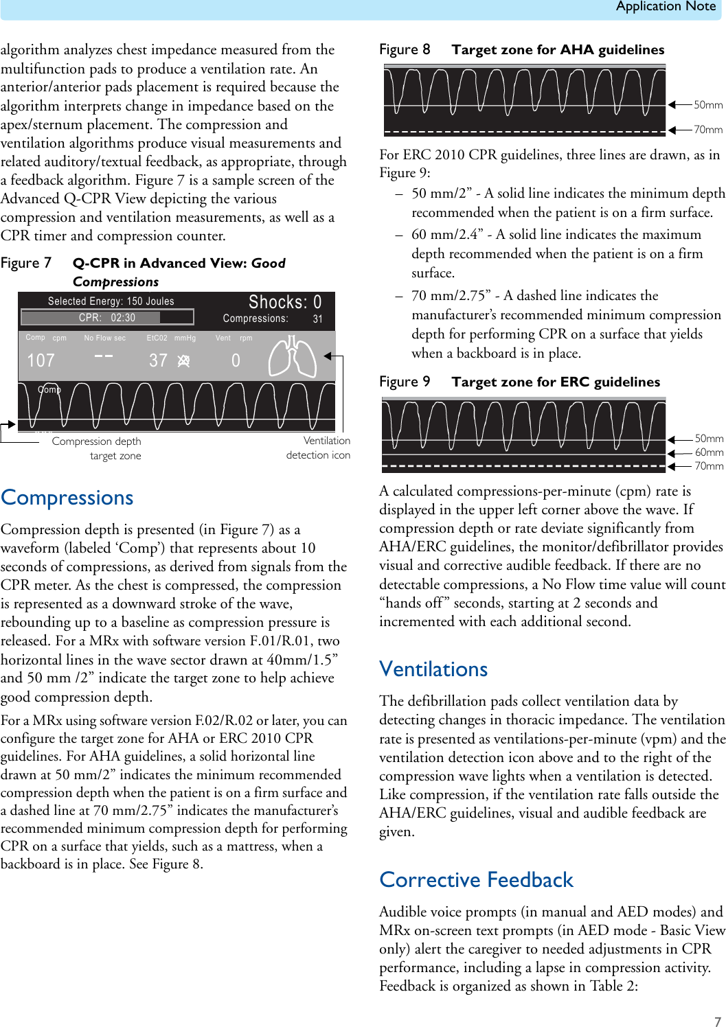 Philips NOCTN89 QCPR App Note_1a User Manual Q CPR Application Note CPR ...