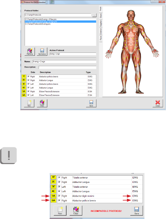 BTS BTSWEMG2 Wireless EMG sensor for EMG system User Manual EREMB 01091 ...