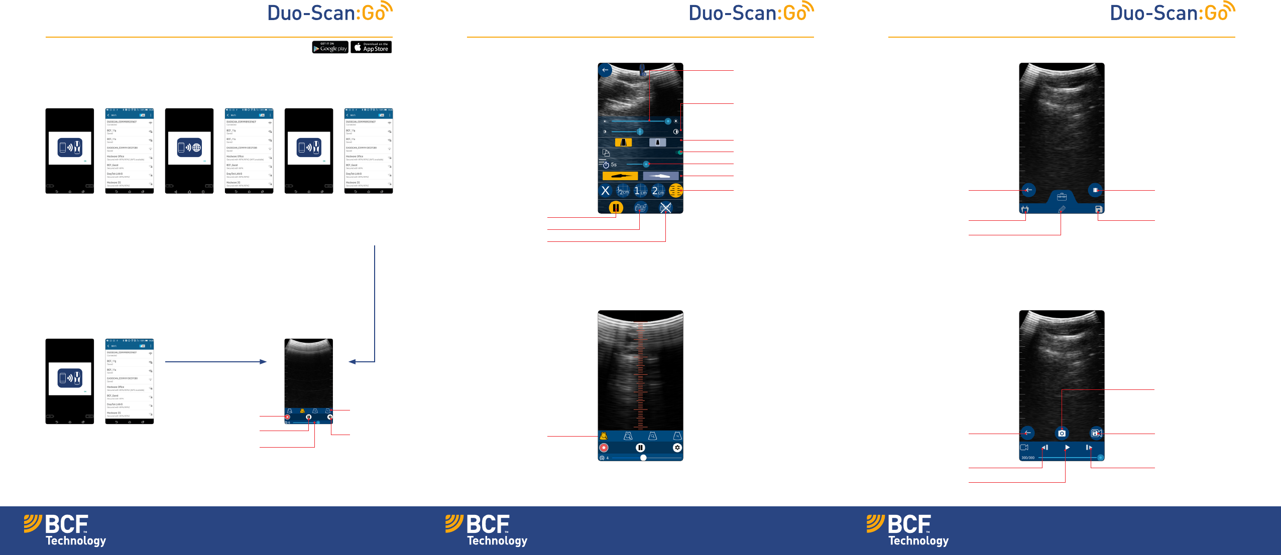 BCF Technology DSGC02 Swine Ultrasound Scanner with WLAN User Manual ...